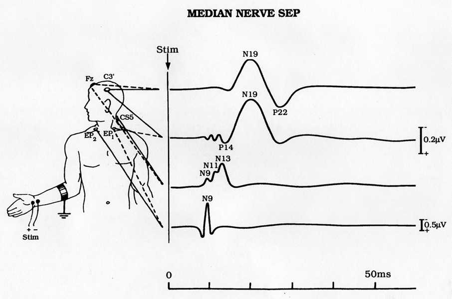 | Electrodiagnosis and Musculoskeletal Associates of Puget Sound